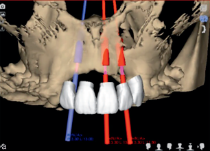 Online Dental CE Webinars And Events | Article - null | DentalXP