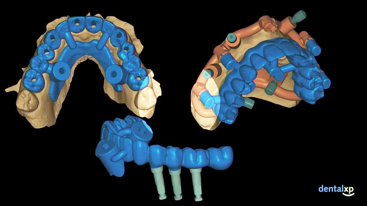 Online Dental CE Webinars And Events | Video - null | DentalXP