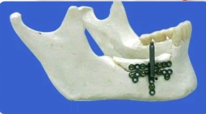 Online Dental CE Webinars And Events | Video - null | DentalXP