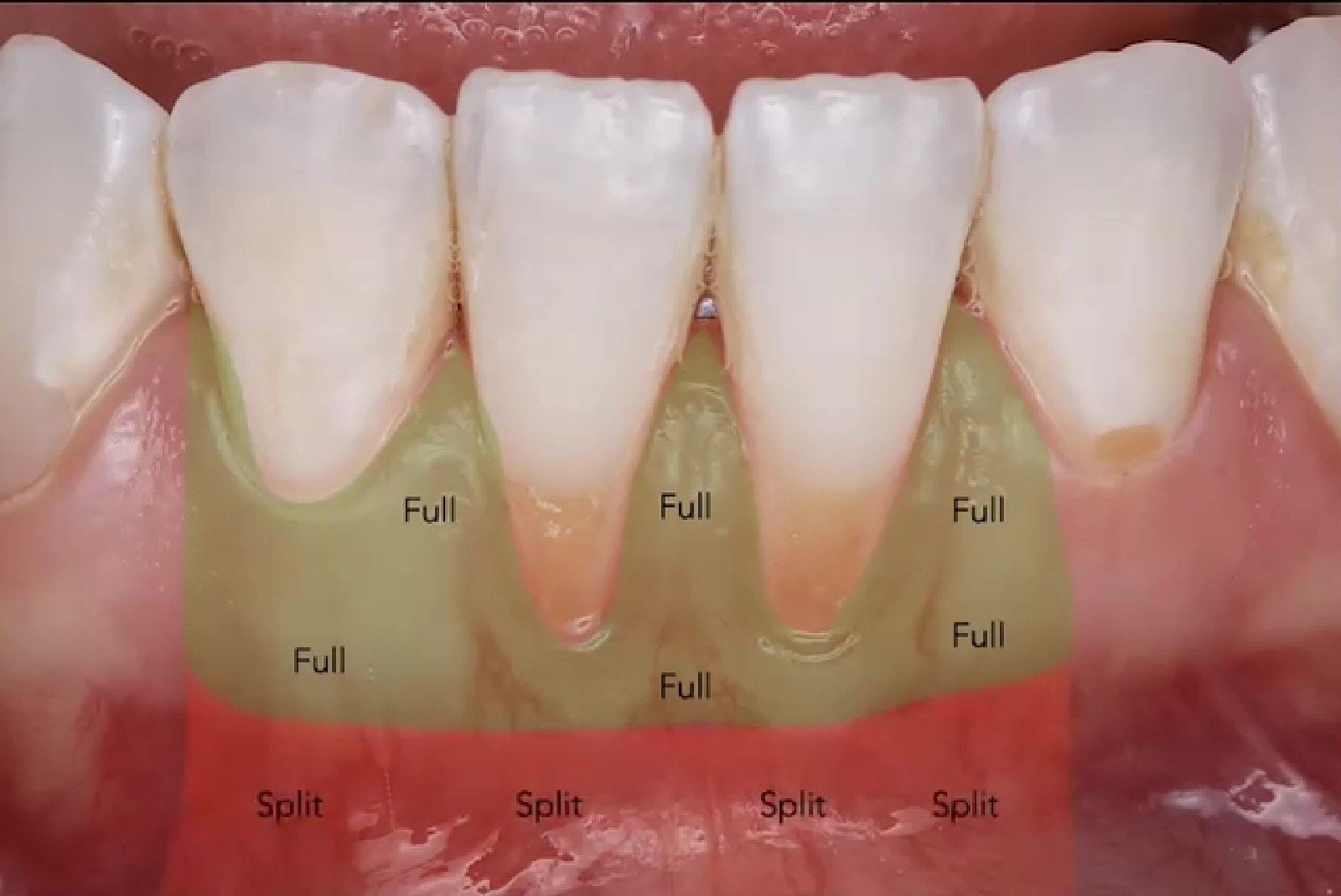 Online Dental CE Webinars And Events | Video - null | DentalXP